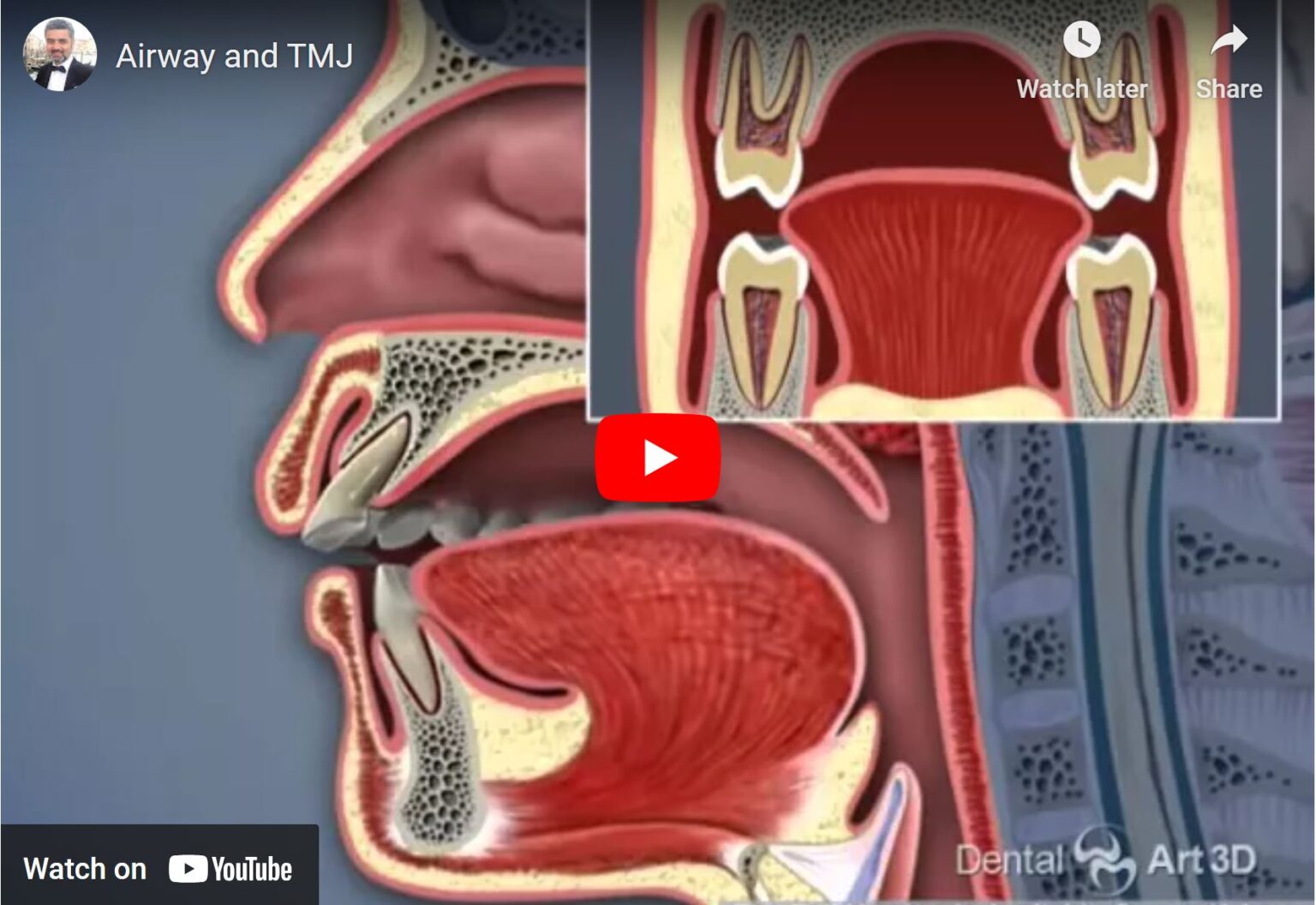 Airway & TMJ: Addressing Dental Impacts