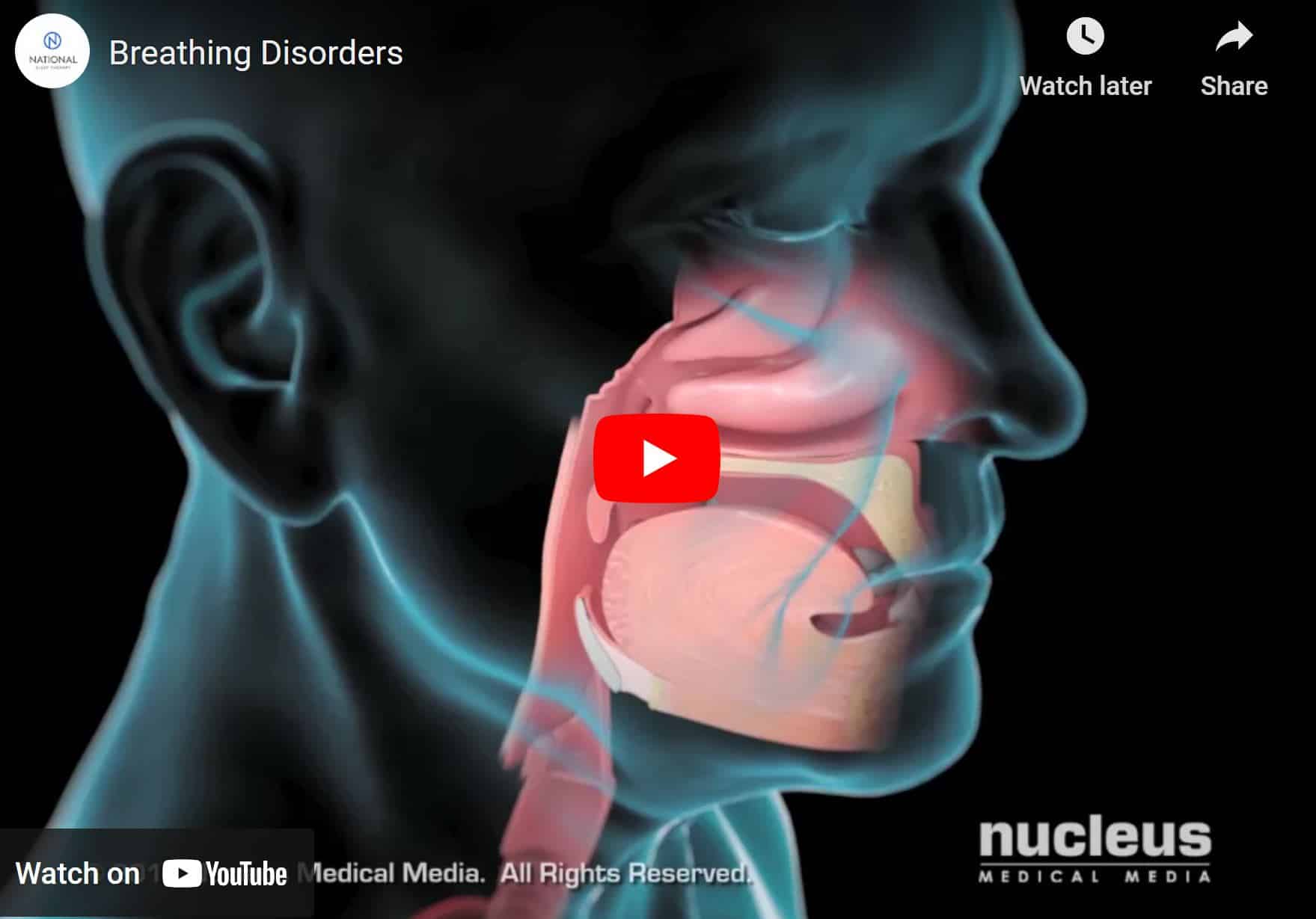 Breathing Disorders: Symptoms and Solutions Explained