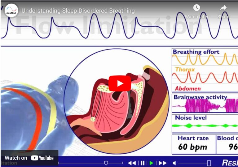 Understanding Sleep Disordered Breathing Causes Explained